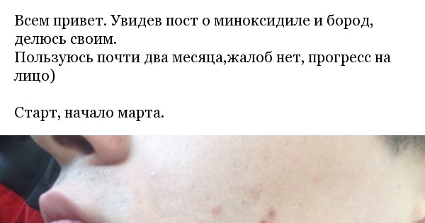 О бороде и алеране | Пикабу