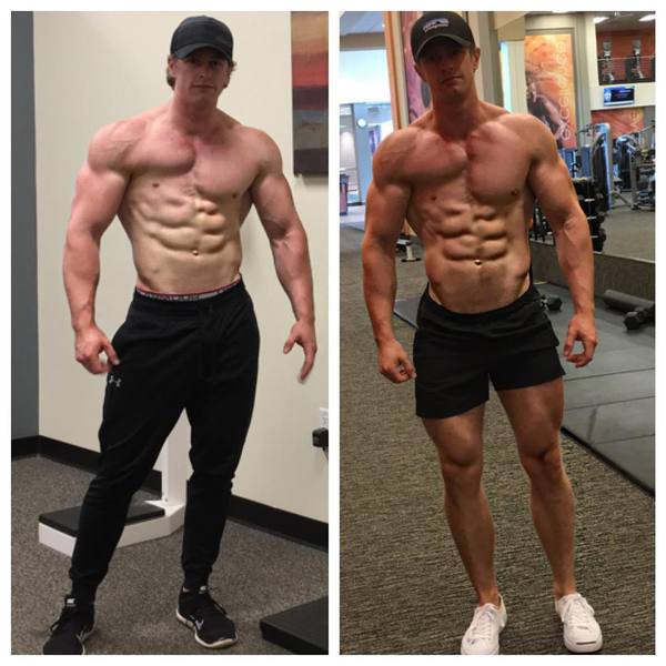 Gunnar Anderson - парень, который родился без правой большой грудной ...